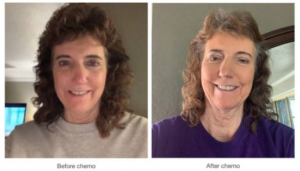 New to Cold Capping? - Start Your Journey Here - Penguin Cold Caps